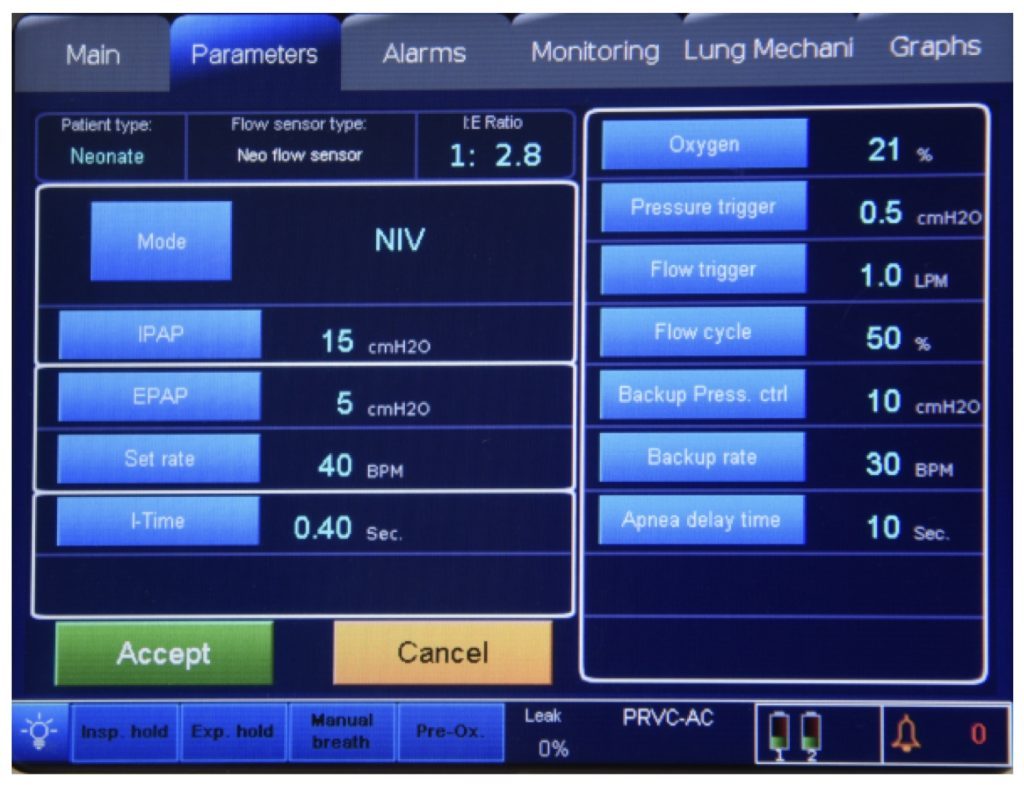 TV-100 Ventilator - Breathing & Medical